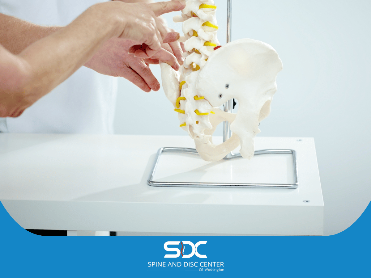 Signs of Reherniation After Microdiscectomy – Spine and Disc Center of ...